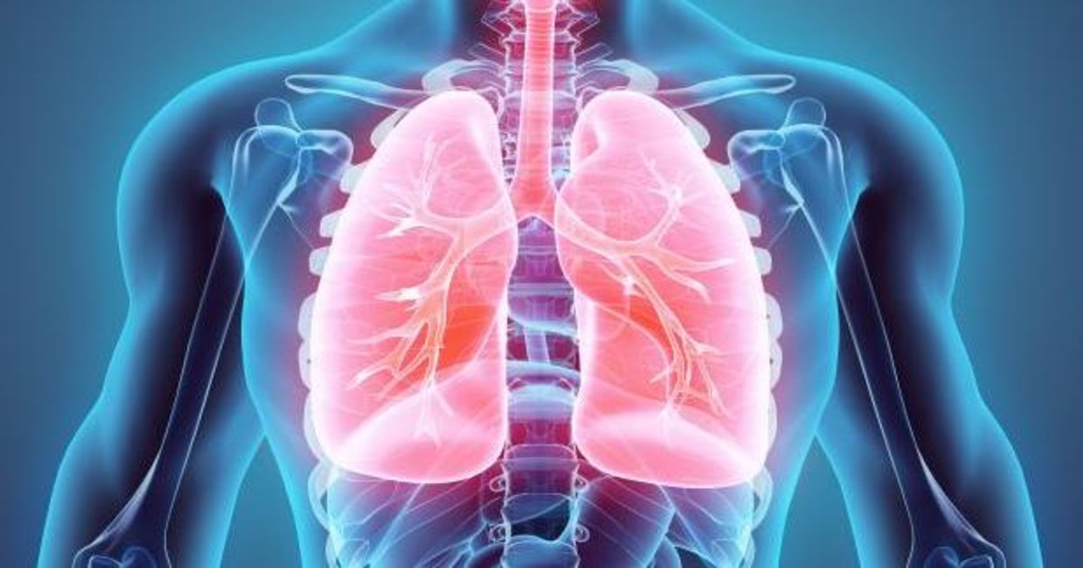 Los problemas pulmonares son las principales secuelas del COVID-19 ...