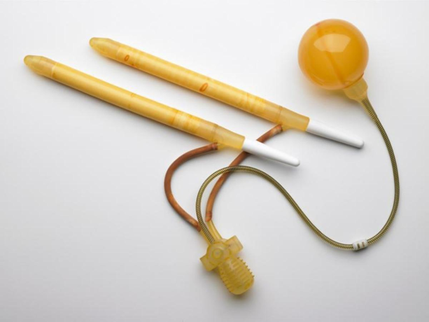 Concretan primera cirugía de implantación de una prótesis hidráulica de ...